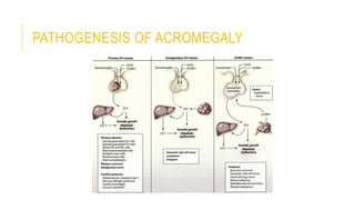 Acromegaly.pptx