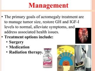 Acromegaly.pptx
