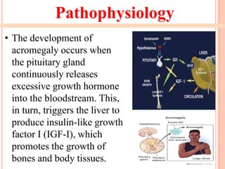 Acromegaly.pptx