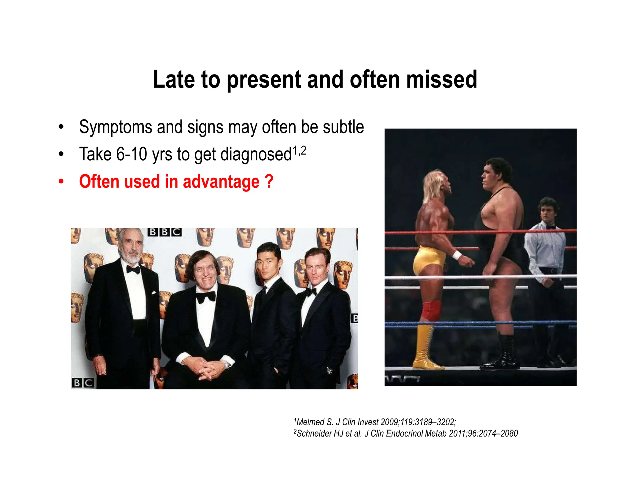 slide about Acromegaly amongs children.pdf