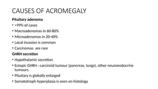 Acromegaly , causes, pathophysiology, mgt | PPTX