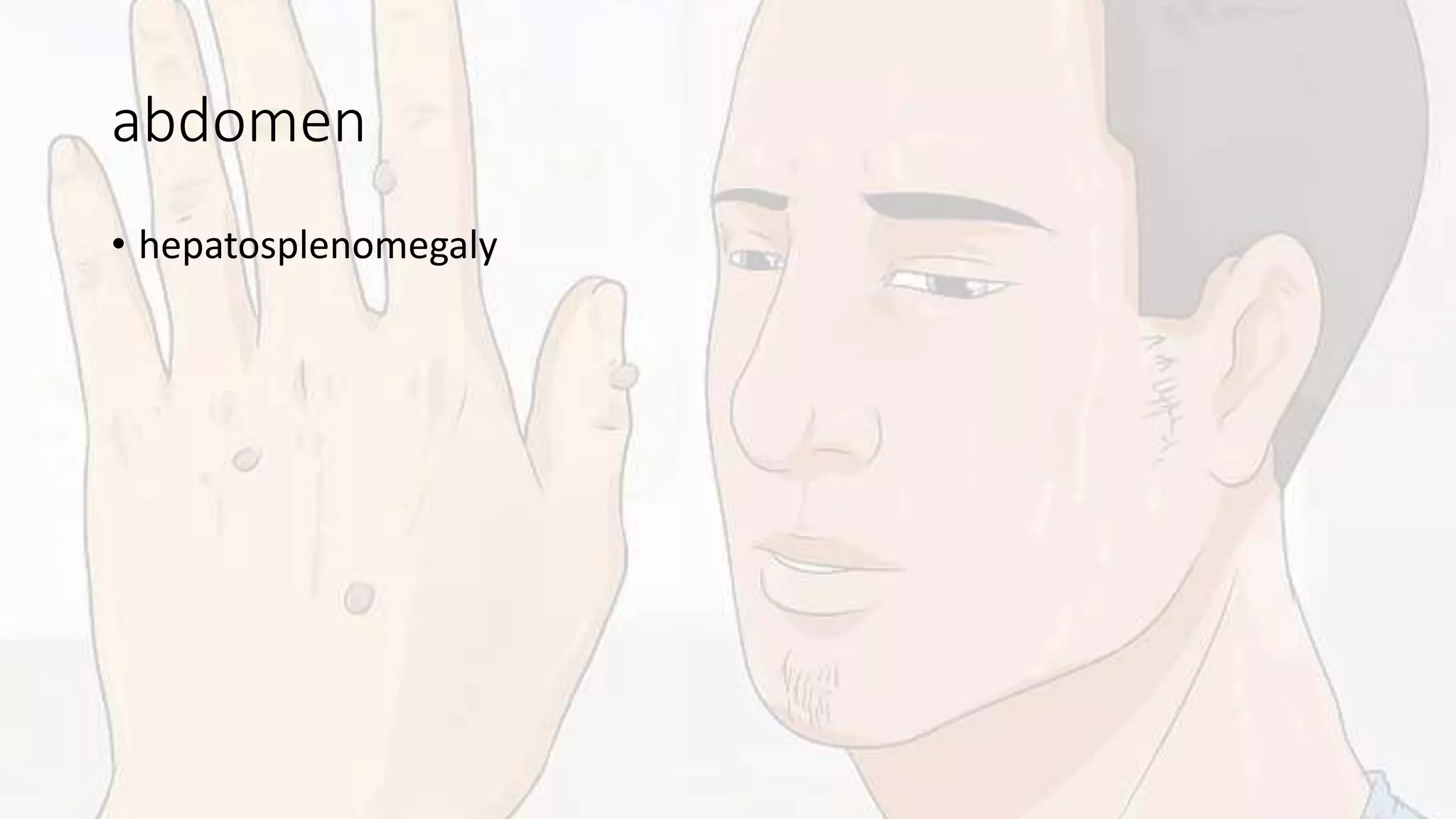 Acromegaly examination (I M GIANT) | PPTX