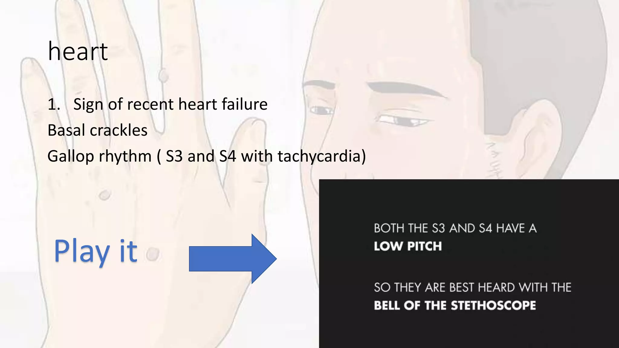 Acromegaly examination (I M GIANT) | PPTX