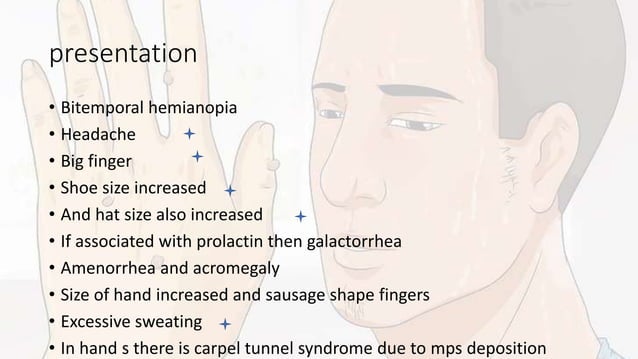 Acromegaly examination (I M GIANT) | PPT