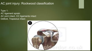 Acromio clavicular joint injury | PPTX
