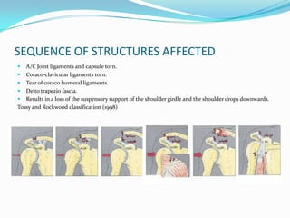 Acromioclavicular joint injury Andrew Gardner NWULG | PPTX