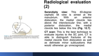 Acromioclavicular.pptx