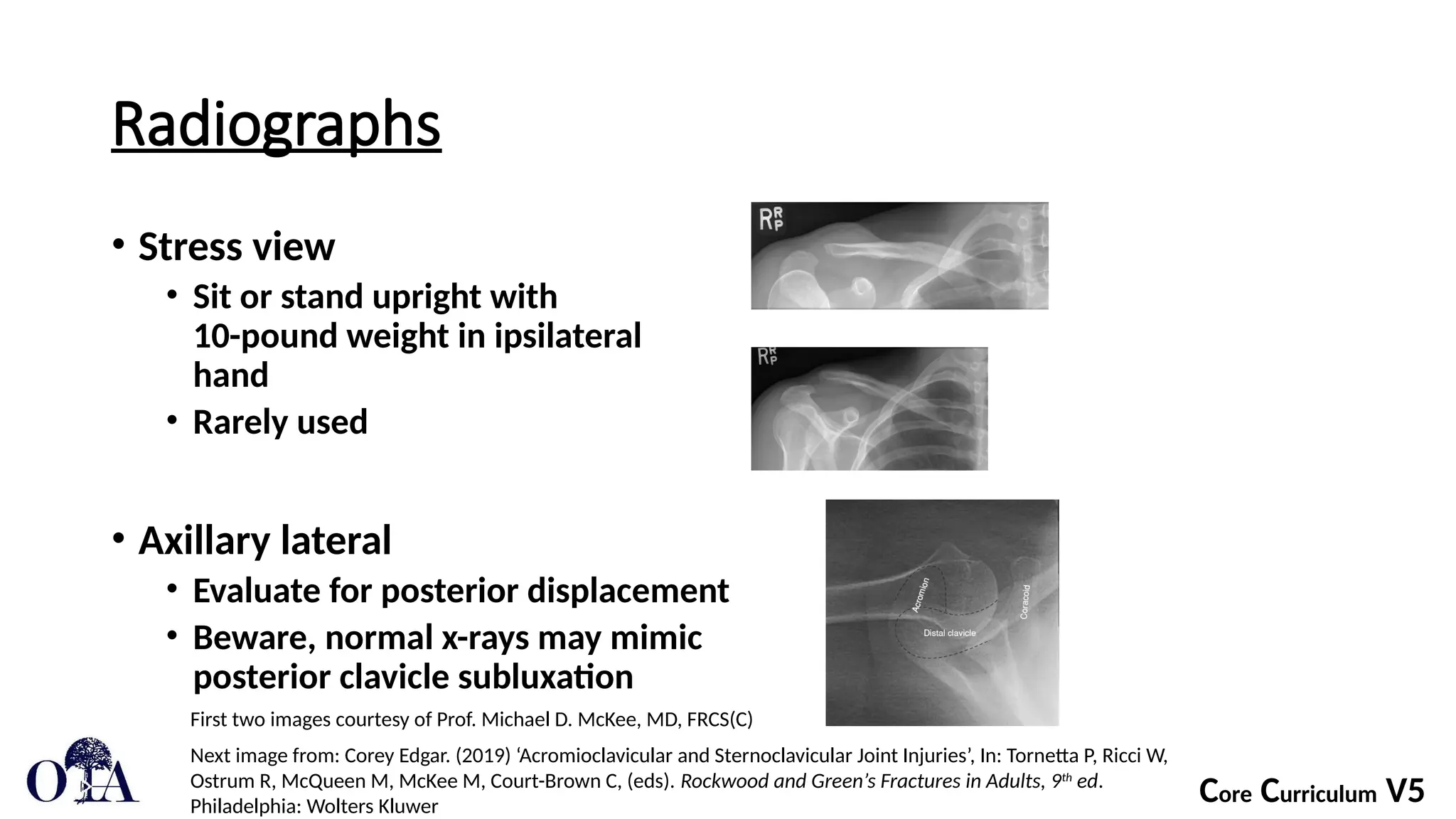 Acromioclavicular and Sternoclavicular Injuries.pptx