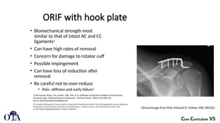 Acromioclavicular and Sternoclavicular Injuries.pptx