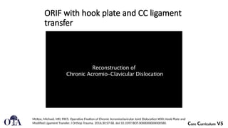 Acromioclavicular and Sternoclavicular Injuries.pptx