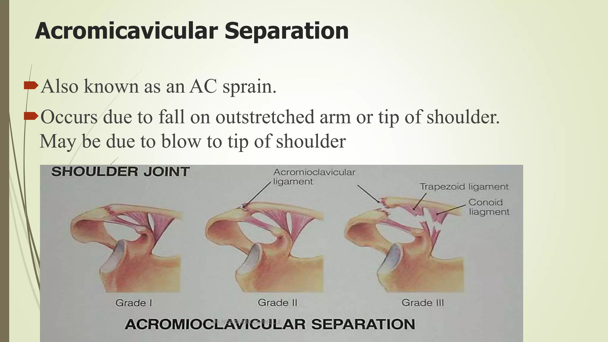 Acromioclavicular and sternoclavicular joint | PPTX