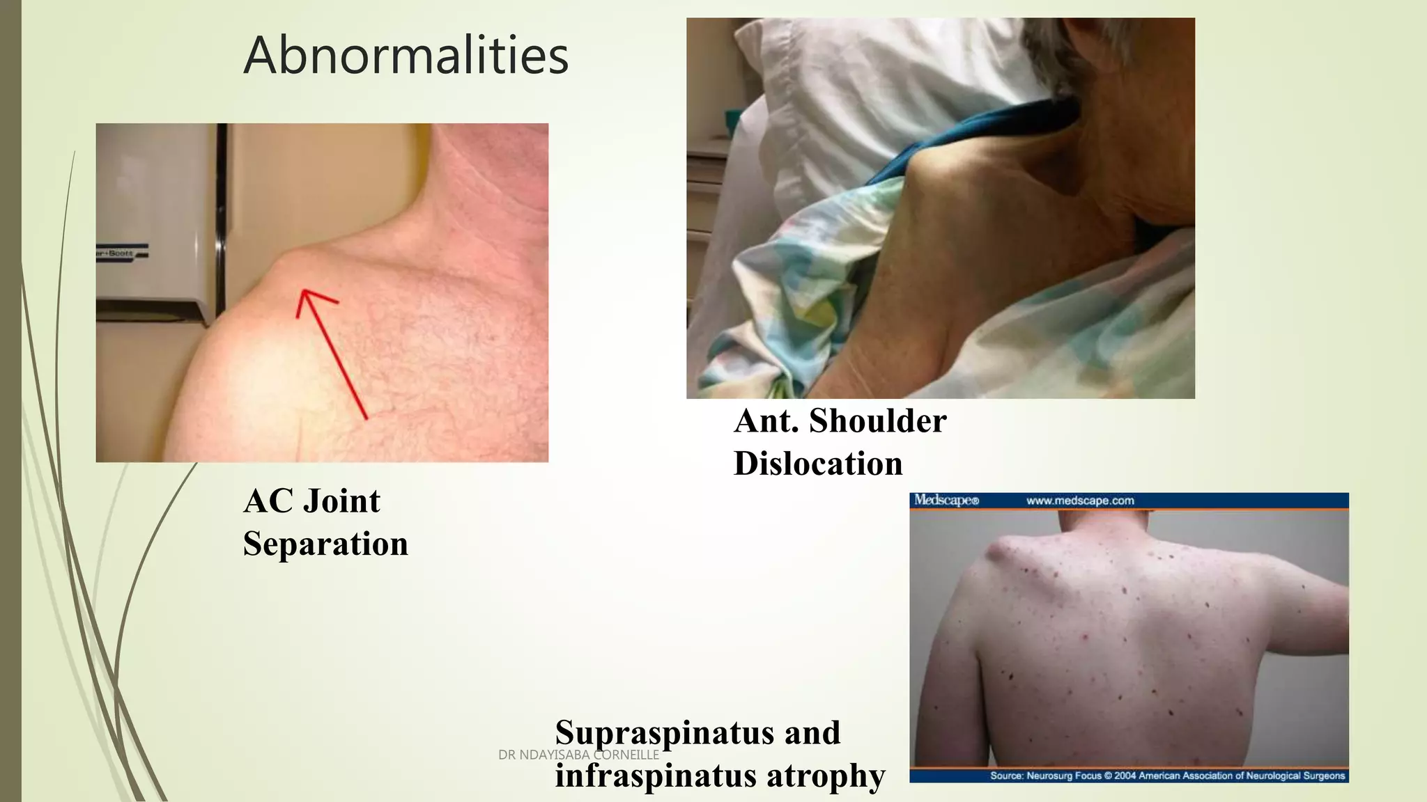 Acromioclavicular and sternoclavicular joint | PPTX