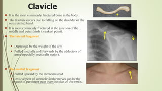 Acromioclavicular and sternoclavicular joint | PPTX | Death, Injury, or ...