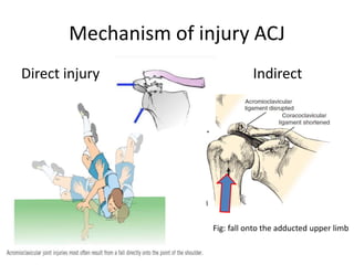 Acromioclavicular and sternoclaviculr injuries | PPTX