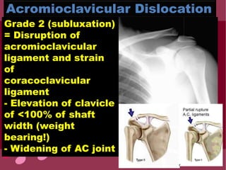Acromioclavicular dislocation | PPTX