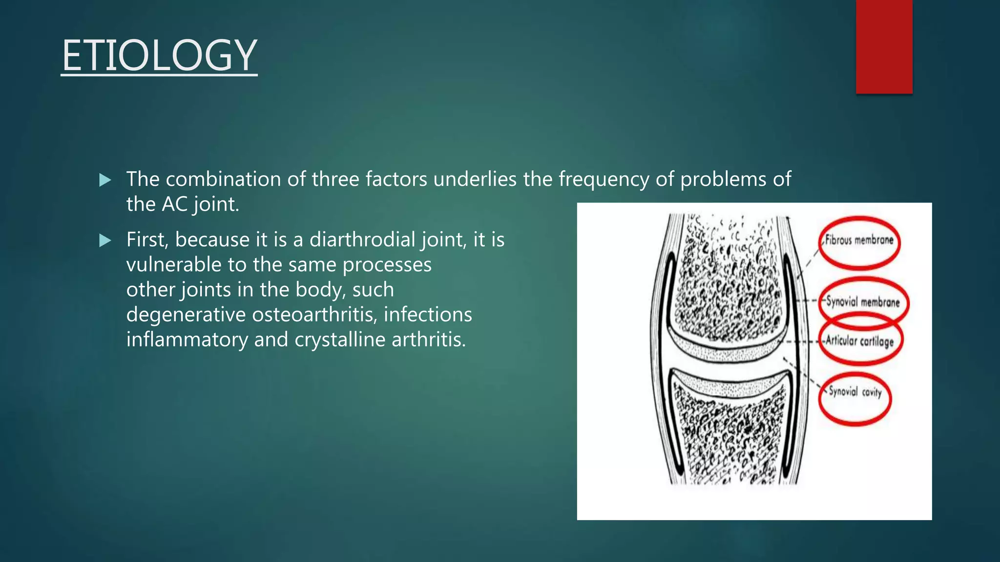 Acromioclavicular joint arthritis | PPTX | Death, Injury, or Military ...