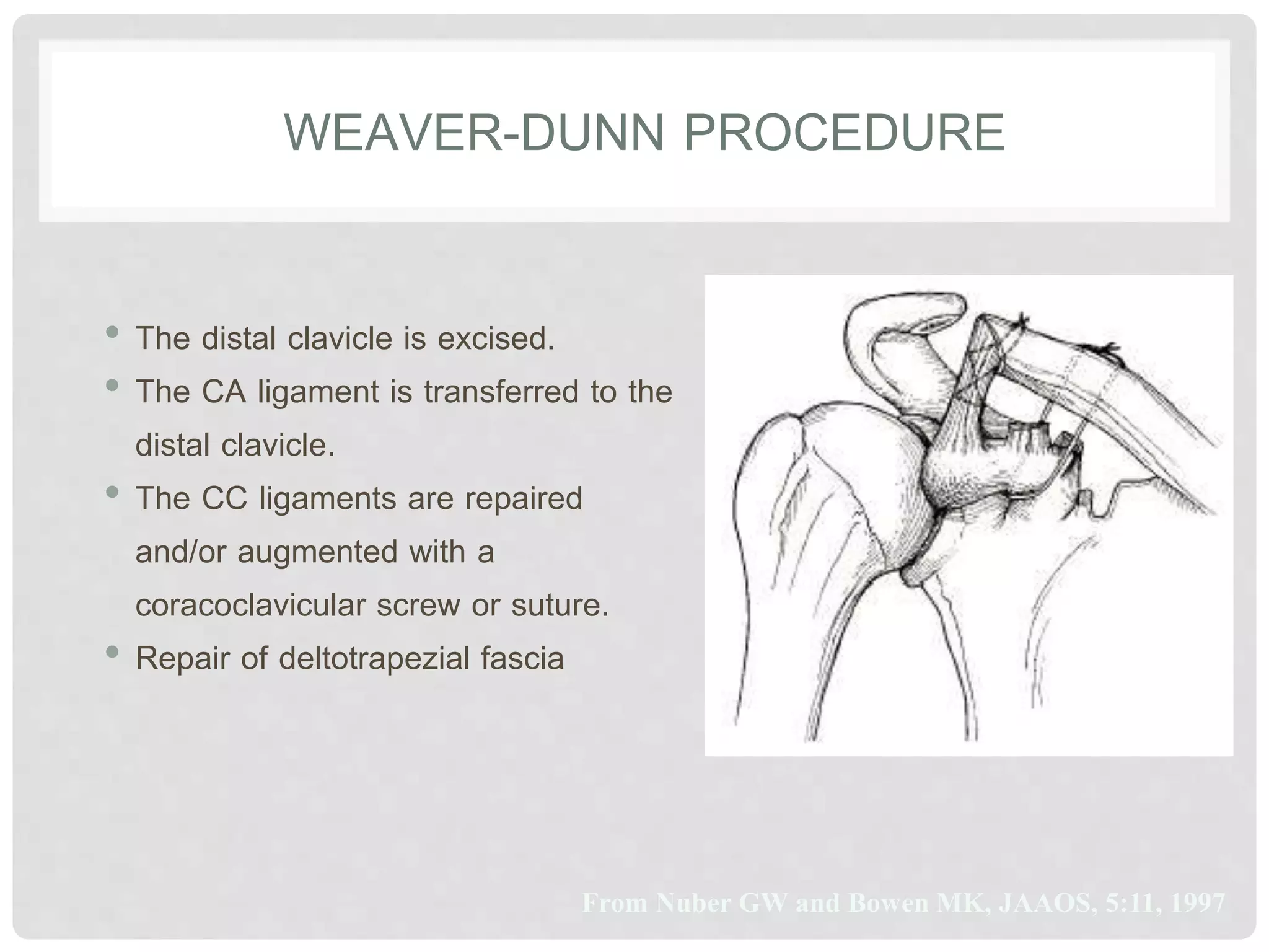 Acromioclavicular joint injury | PPTX