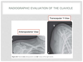Acromioclavicular joint injury | PPTX