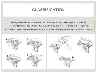 Acromioclavicular joint injury | PPTX