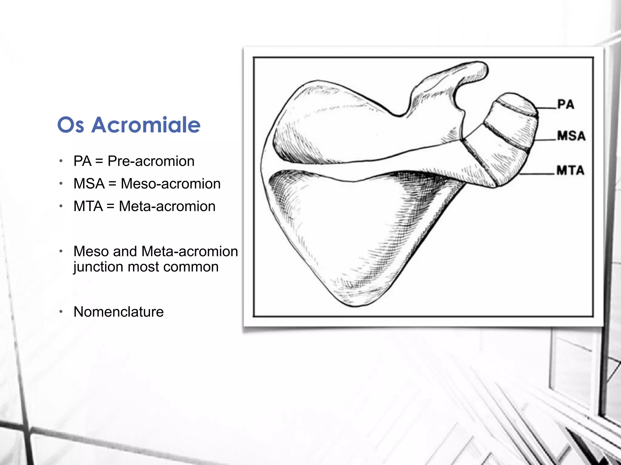 Acromion - Os-acromiale Fractures and Insufficiency | PDF