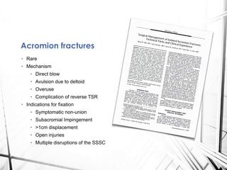 Acromion - Os-acromiale Fractures and Insufficiency | PDF