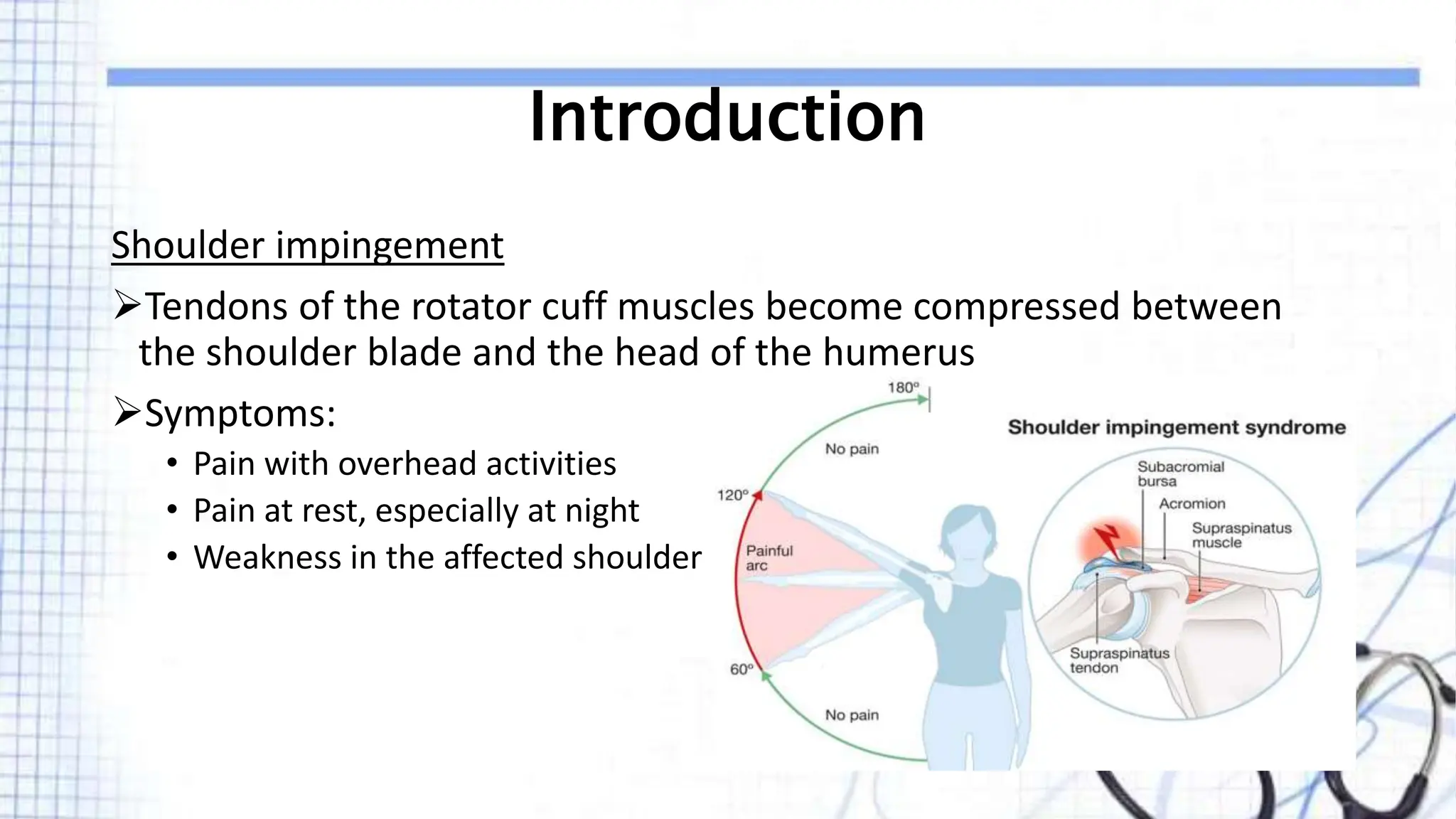 Indications and treatment of shoulder infringement. Acronum.pptx