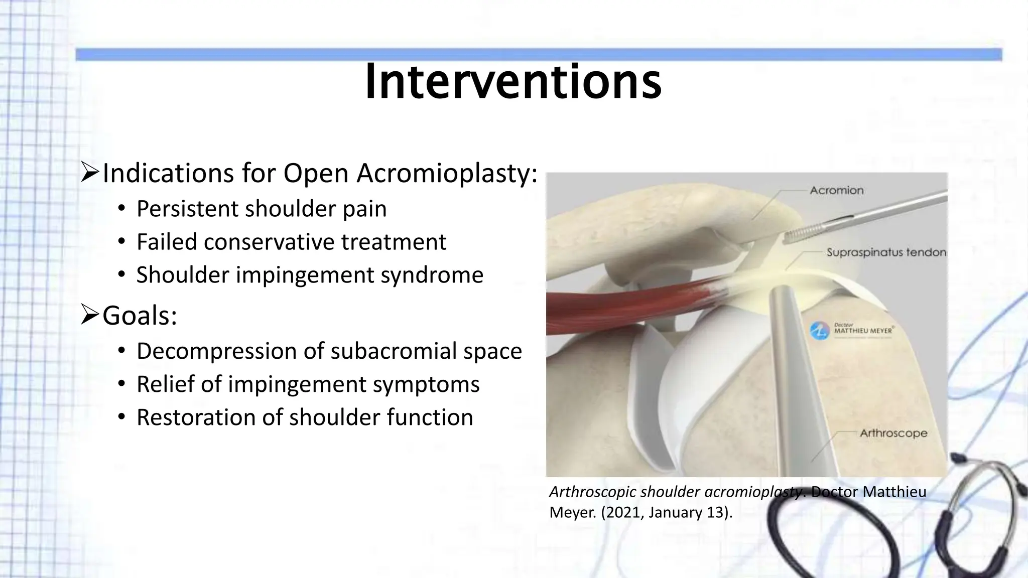 Indications and treatment of shoulder infringement. Acronum.pptx