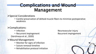 Indications and treatment of shoulder infringement. Acronum.pptx