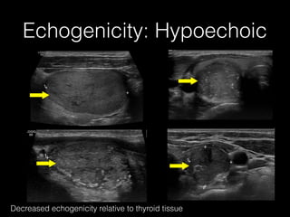 ACR TI-RADS Atlas.pdf