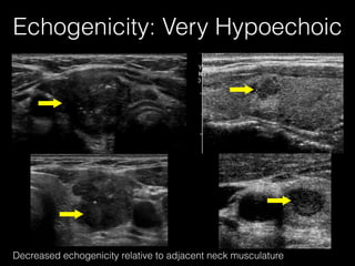 ACR TI-RADS Atlas.pdf