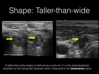 ACR TI-RADS Atlas.pdf