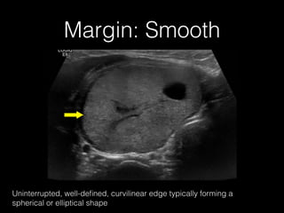 ACR TI-RADS Atlas.pdf
