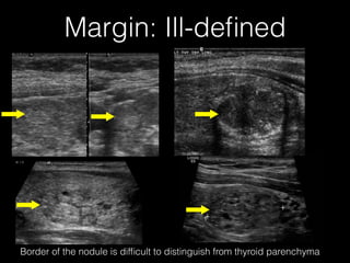 ACR TI-RADS Atlas.pdf