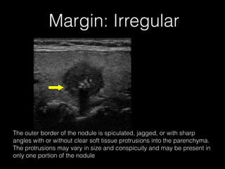 ACR TI-RADS Atlas.pdf
