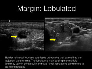 ACR TI-RADS Atlas.pdf