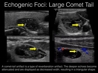 ACR TI-RADS Atlas.pdf