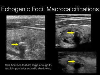 ACR TI-RADS Atlas.pdf