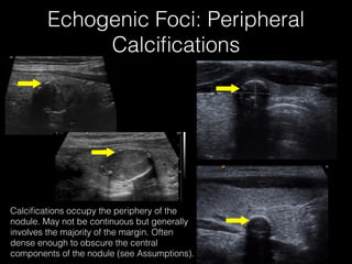 ACR TI-RADS Atlas.pdf