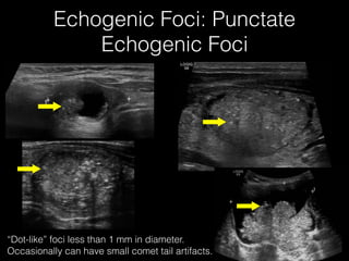 ACR TI-RADS Atlas.pdf