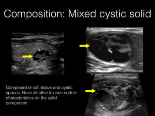 ACR TI-RADS Atlas.pdf