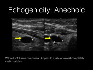 ACR TI-RADS Atlas.pdf