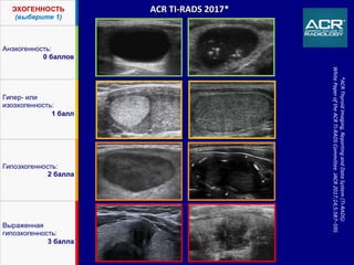 ACR TI-RADS and TBSRTS: 2019 | PPT
