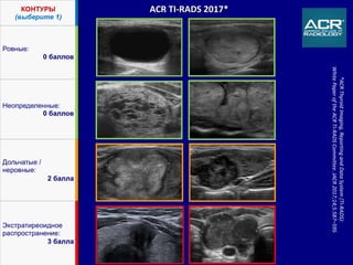 ACR TI-RADS and TBSRTS: 2019 | PPT