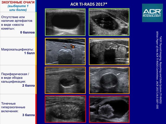 ACR TI-RADS and TBSRTS: 2019 | PPT
