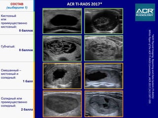 ACR TI-RADS and TBSRTS: 2019 | PPT