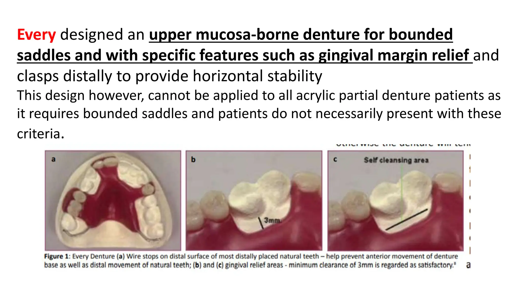 ACRYLIC PARTIAL DENTURES................ | PPTX