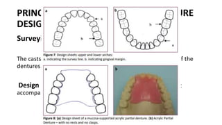 ACRYLIC PARTIAL DENTURES................ | PPTX