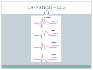 Acute Coronary Syndrome | ODP