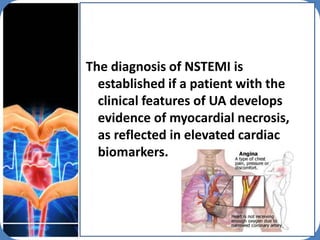 Acute coronary syndrome | PPTX