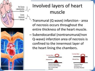 Acute coronary syndrome | PPTX